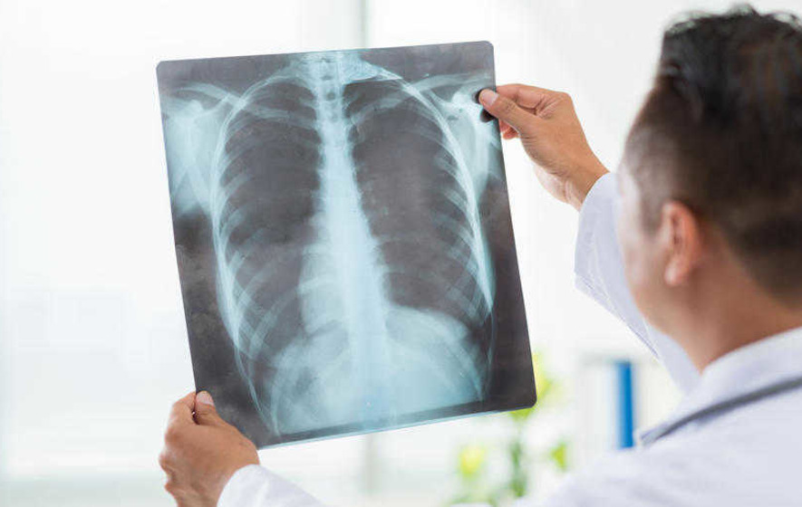 Pneumonia, boala care se transmite | Sanatate de fier